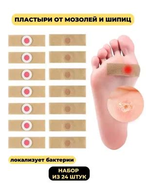 Шипица на ноге картинки - 80 фото