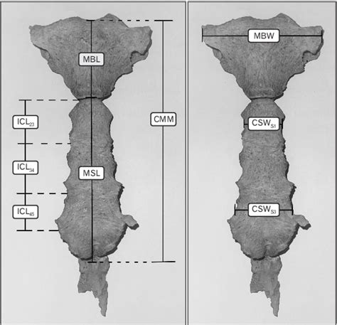 Table 1 From Stature Estimation Using The Sternum In A Thai Population Semantic Scholar