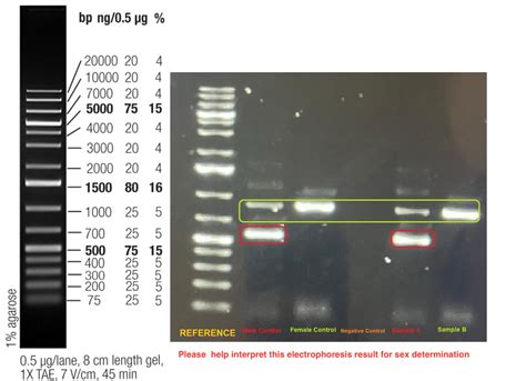 Solved Help Me Interpret This Gel Electrophoresis Result In