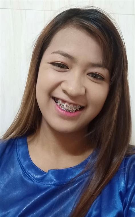 ឥទិ្ធពលព ត់ធ្មេញ ប្រែសម្រស់តារាស្រីទាំងនេះ កាន់តែស្អាត ញញឹមជឿជាក់ Khmerload Cambodia Latest News