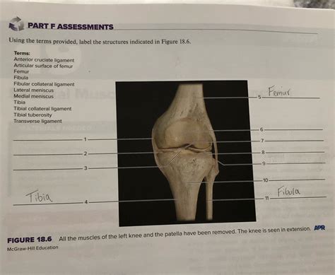 [solved] Using The Terms Provided Label The Structures Indicated In Figure Course Hero