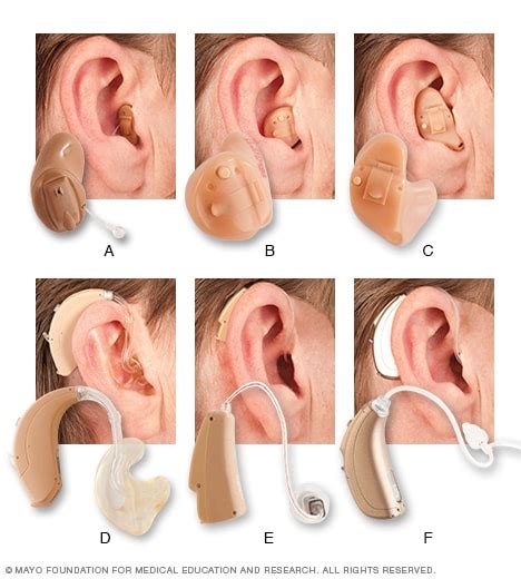 Hearing Aid Comparison Chart Keski
