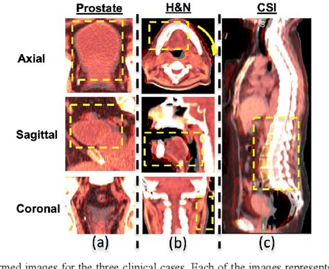 Figure 1 From Performance Variations Among Clinically Available