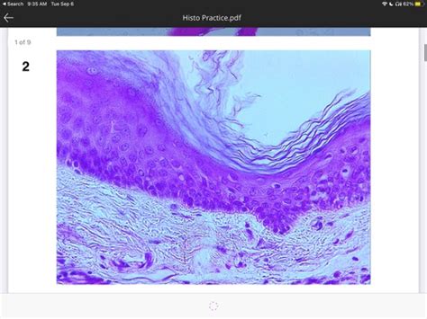 Lecture Exam 2 CHAPTER 6 Flashcards Quizlet