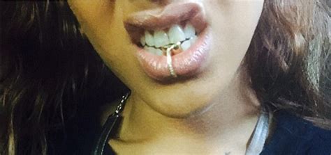 Rihanna Shows Off Brand New Mouth Piercings On Instagram Nowrunning