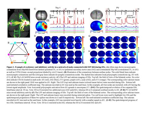 Excitatory And Inhibitory Spatial Mismatch Mediates The Global Propagation Of Interictal Spikes