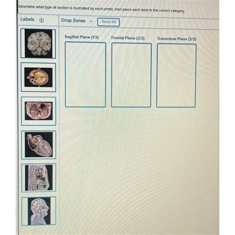 Solved Determine What Type Of Section Is Illustrated By Each Chegg Com