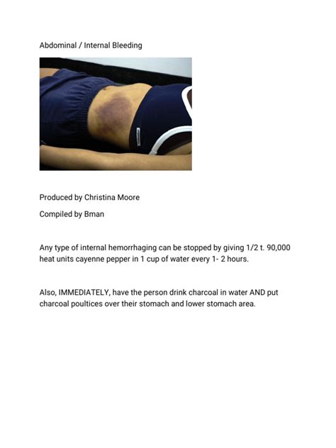 Abdominal Internal Bleeding Pdf
