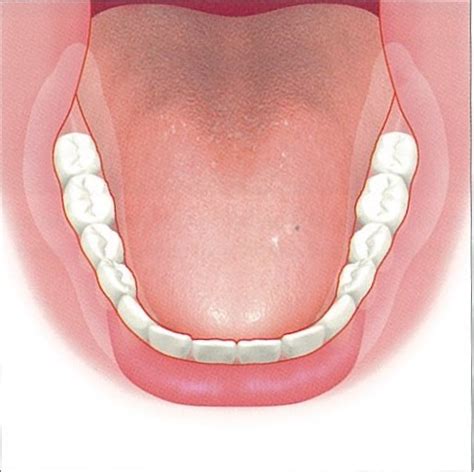 Suction Effective Mandibular Complete Denture Semcd
