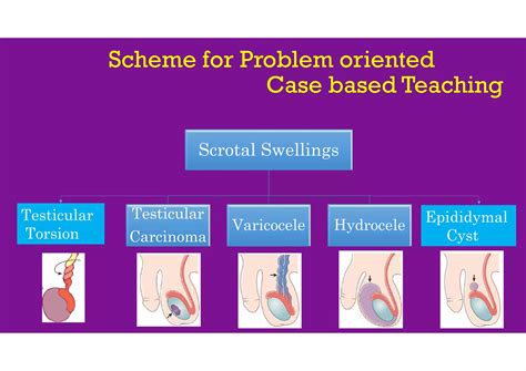 Scrotal Swellings Pdf