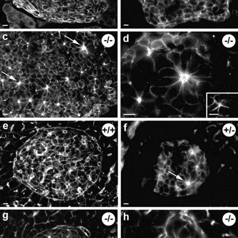 Subcellular Organization Of N Cadherin And F Actin Is Altered In
