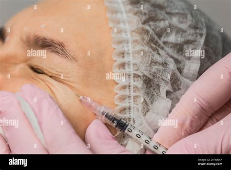 Contour Plastic A Cosmetologist Injects A Botulinum Toxin To Tighten