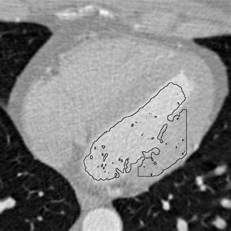 Segmentation Results By Using The First Image Of Figure 1with The Download Scientific Diagram