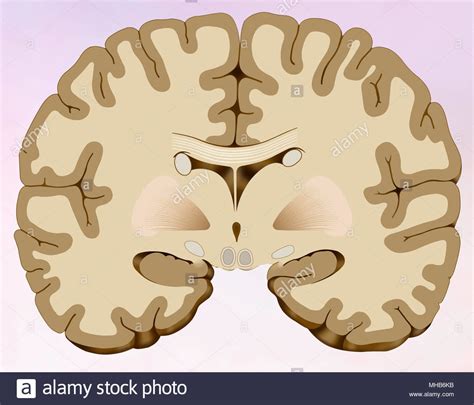 Neuroanatomy Coronal Section Diagram Quizlet