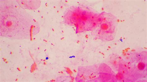 Bacteria Cell Gram Neagative Bacilli With Capsule Pathogensample Sputum