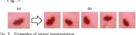 Figure 3 From Multi Class Classification Of Skin Diseases Using Resnet50 Semantic Scholar