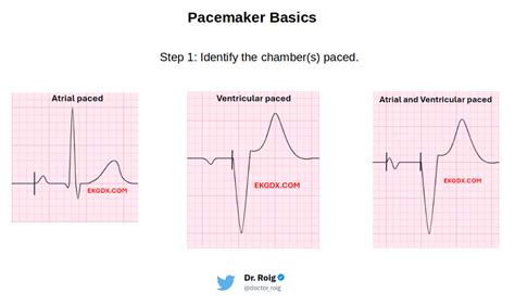 Ekgdx La Nueva Era Del Aprendizaje De Ekg