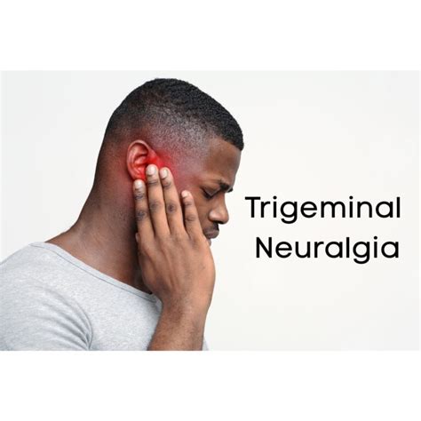 Understanding Trigeminal Neuralgia Causes And Treatments