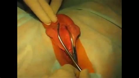 Cutting Big Pussy Lips Right Off Bizarre Porn At Thisvid Tube