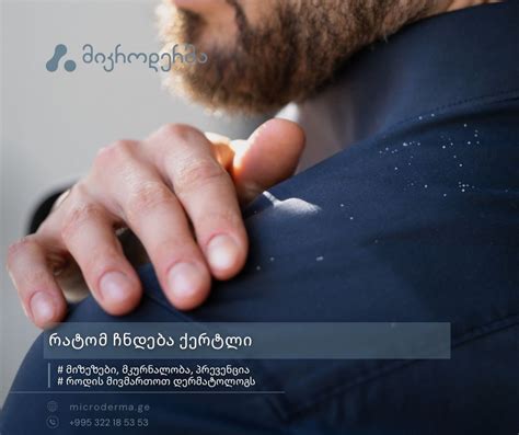 💬 ქერტლი ერთ ერთი ყველაზე გავრცელებული პრობლემაა რომელიც ხშირად იწვევს… Microderma • მიკროდერმა