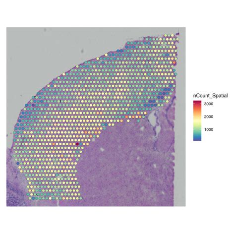 Multi Resolution Deconvolution Of Spatial Transcriptomics In R — Scvi Tools