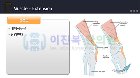 전주 이진복한의원 무릎 관절의 해부학적 구조