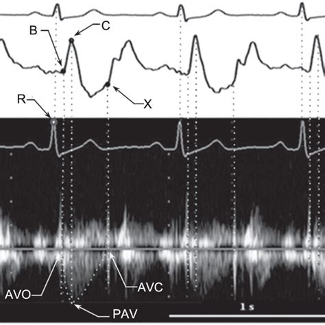 Example Of Simultaneously Recorded Icg And Ecg With Time Aligned Download Scientific Diagram