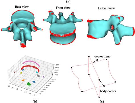 Figure 1 From An Automatic Method For Landmark Identification Of The 3d Vertebrae Semantic Scholar