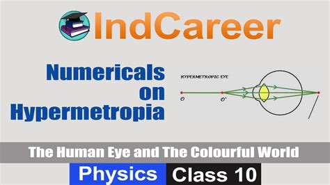 Numerical On Hypermetropia Physics Class 10 Indcareer Youtube