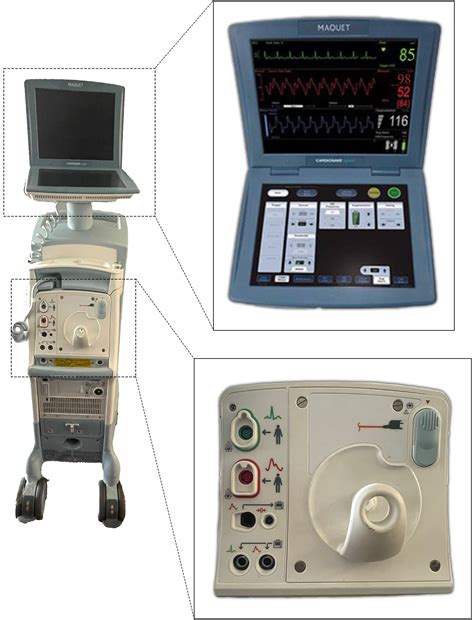 The Intra Aortic Balloon Pump A Focused Review Of Physiology