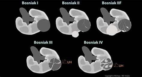 A Glossary Of Commonly Used Classifications In Medical Imaging