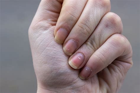 What Are White Spots On Your Nail Design Talk