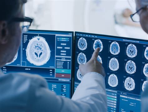 Navigating Imaging Options For Brain Aneurysms Brain Aneurysm Foundation