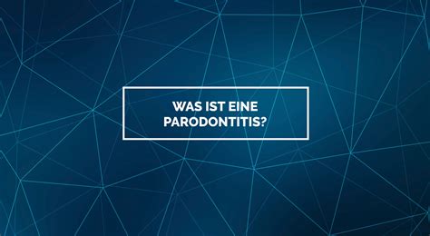Parodontitis Prof Andreas Braun Beantwortet Im Video Die Wichtigsten Fragen