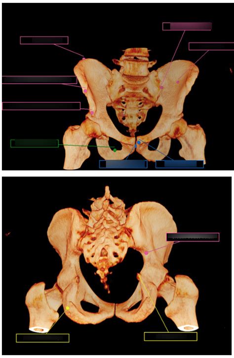 Module 5 Part 1 Pelvic Girdle Diagram Quizlet