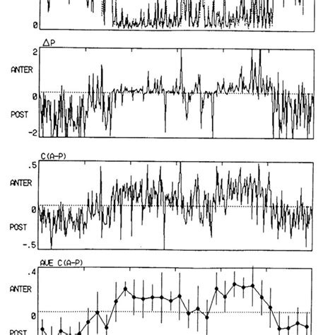 A Hemispheric Asymmetry Of Eeg Alpha Activity At The Wake Sleep Download Scientific Diagram