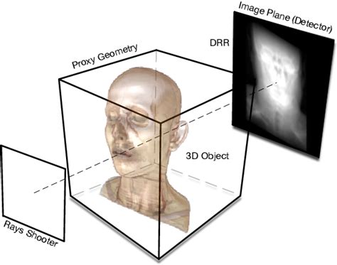 Figure 1 From Gpu Acceleration For Digitally Reconstructed Radiographs Using Bindless Texture