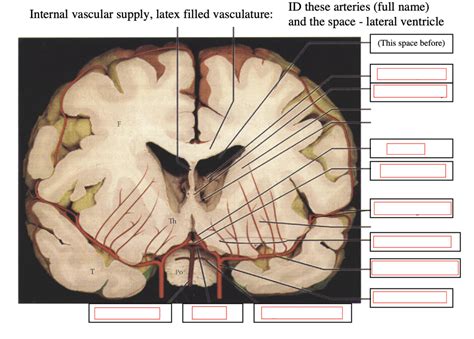 Neuroscience Exam Anatomy Id Diagram Quizlet