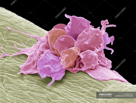 Coloured Scanning Electron Micrograph Of Activated Platelets Attached To Surgical Gauze