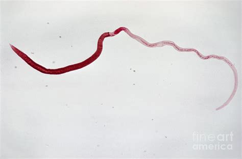 Platynosomum Fastosum Lm Photograph By Eric V Grave Fine Art America