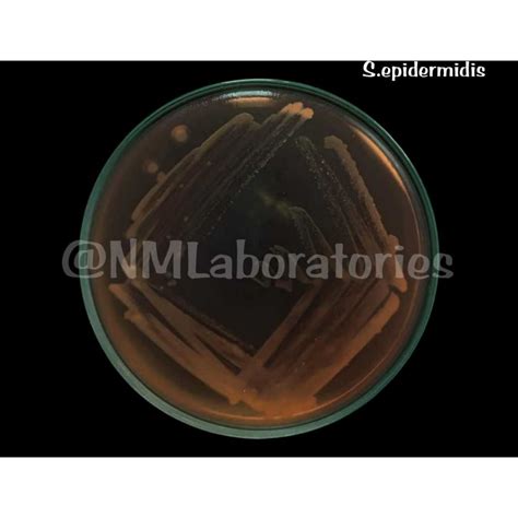 Jual Isolat Bakteri Staphylococcus Epidermidis S Epidermidis Media Msa Shopee Indonesia