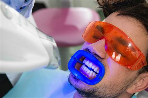 Professional Teeth Whitening Dentist Administered Whitening Treatments