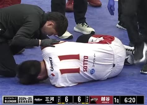 重大打击🤕22岁菲律宾中锋索托前十字韧带撕裂 至少将缺阵6个月 直播吧