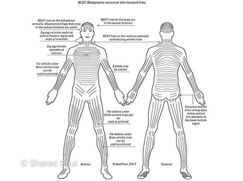 Skin Tension Lines