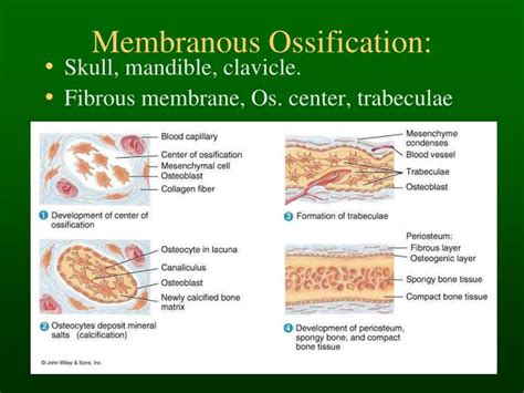 Ppt Bone Histology And Fracture Healing Powerpoint Presentation Id
