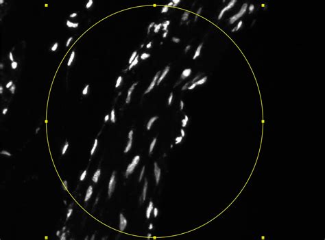 QuPath Detecting One Nucleus As Two Image Analysis Image Sc Forum