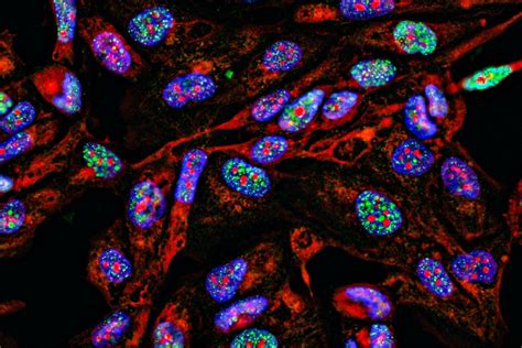 Biomarker Testing Consolidation And Implementation Using Multiplex Immunofluorescence