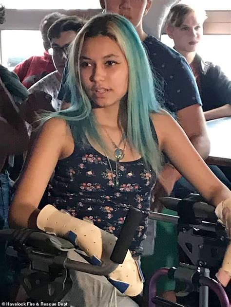 Teen Shark Attack Victim Is Released From North Carolina Hospital Daily Mail Online