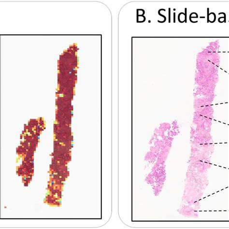 A Patch Wise And B Slide Based Histopathological Analyses Download Scientific Diagram