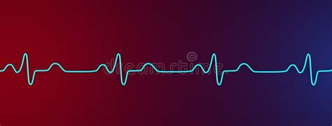 Ecg Of Bundle Branch Block 3d Illustration Stock Illustration